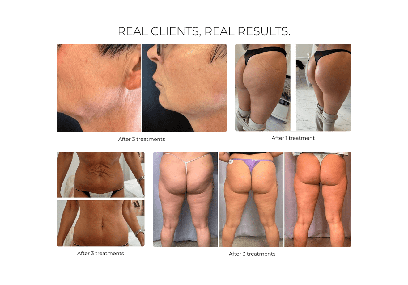 T-Shape 2 – Basis Holistics